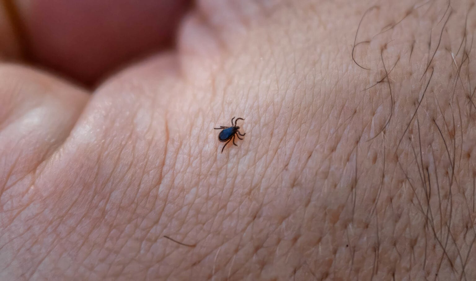 Protecting Forests by Managing the Exploding Deer Population - Scenic ...